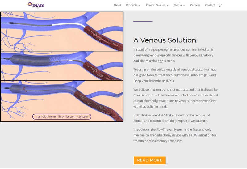 Inari Medical Inc. (NARI) | IPO 2020