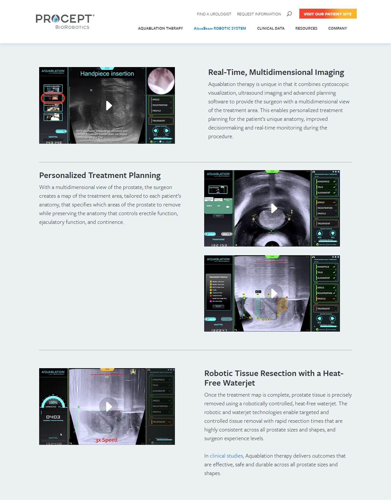 PROCEPT BioRobotics (PRCT) | IPO 2021