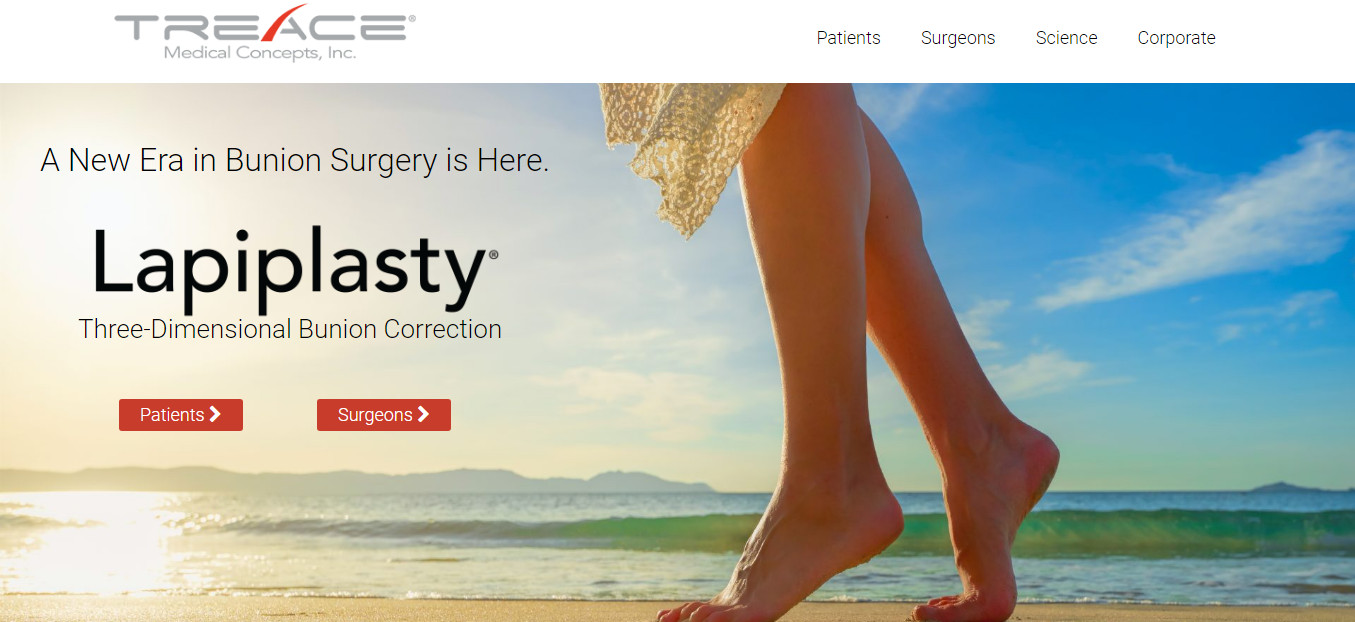 Treace Medical Concepts (TMCI) | IPO 2021