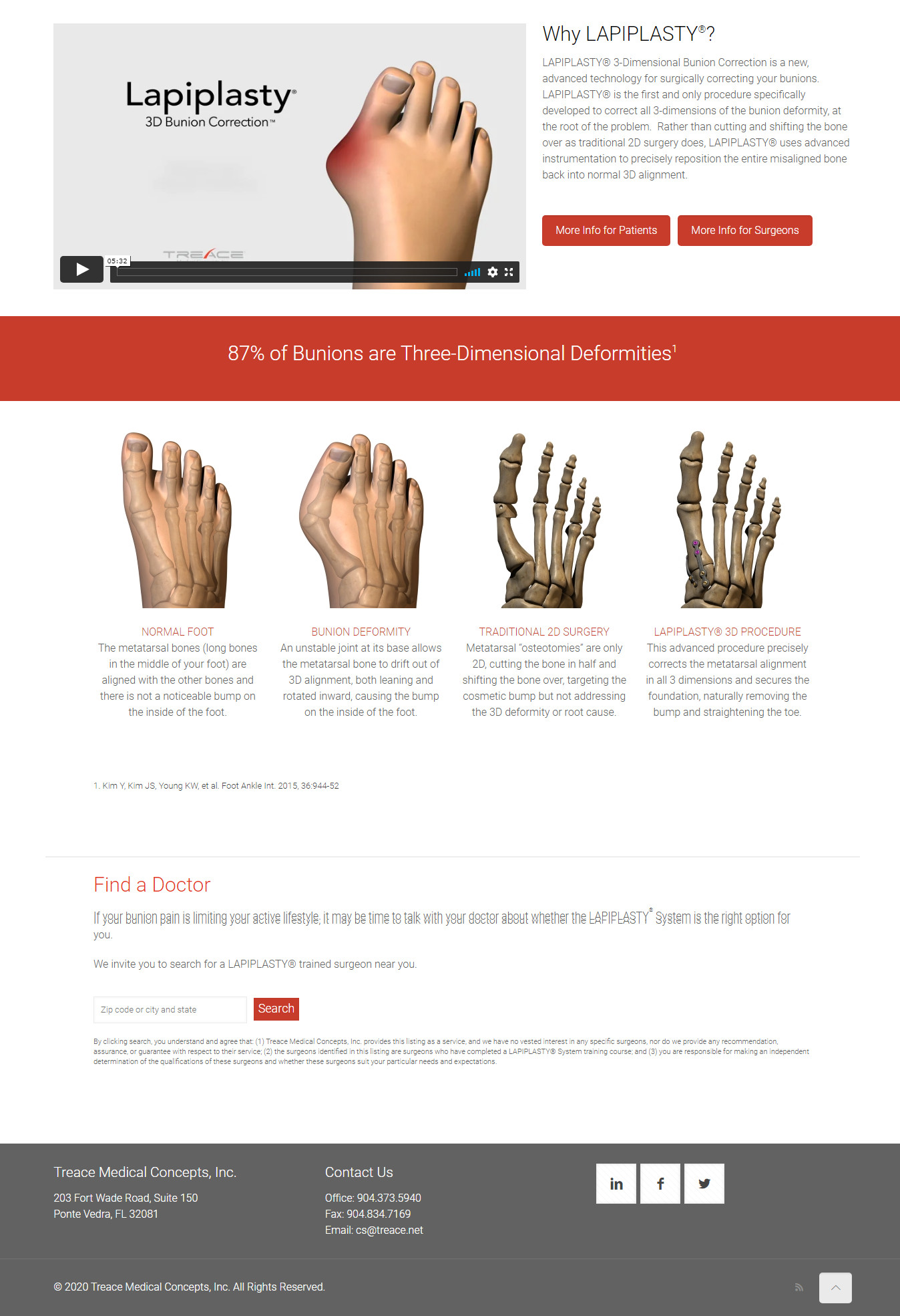 Treace Medical Concepts (TMCI) | IPO 2021